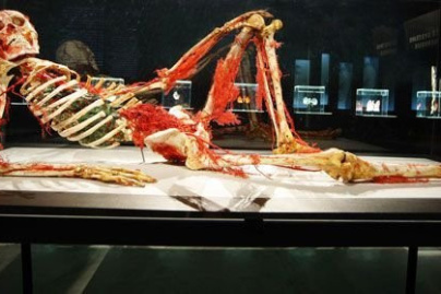 L'exposition our body interdite - Sortiraparis.com